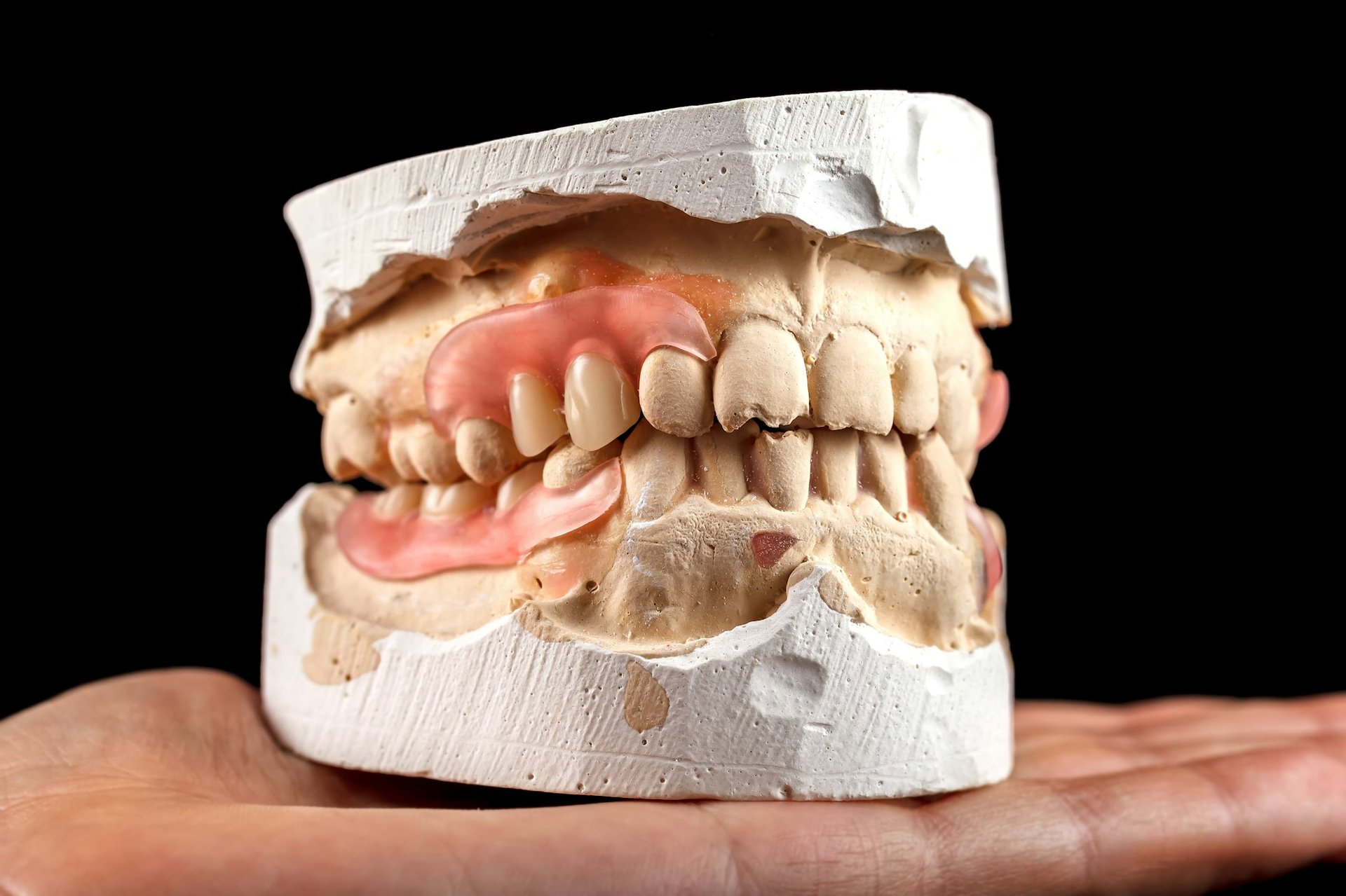 What Are Types Of Dentures? l Health Centers Turkey