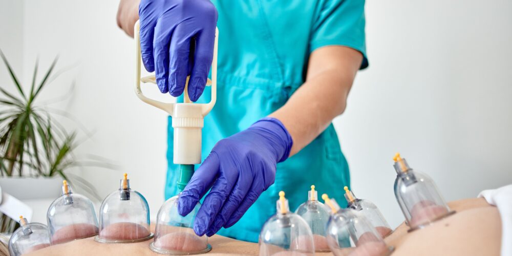 Exploring Cupping Therapy | Health First Wellness