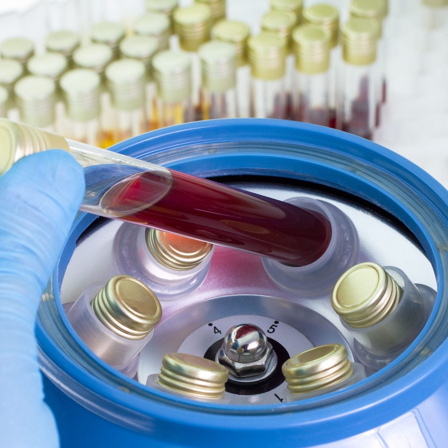 Regenerative Medicine - PRP and Stem Cell Injections - Limbic Medical ...